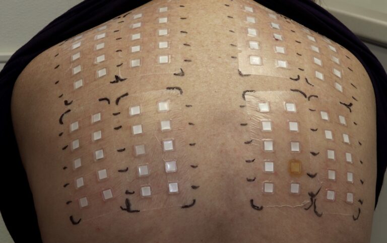 Toename aantal mensen met allergie verzorgingsproducten - StopAllergie.nl